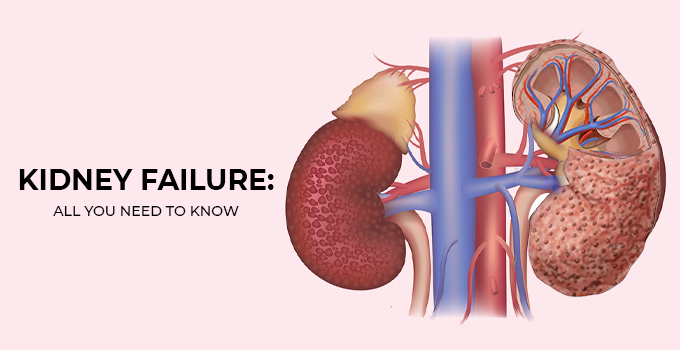 Facts About Stages Of Kidney Failure | MrMed